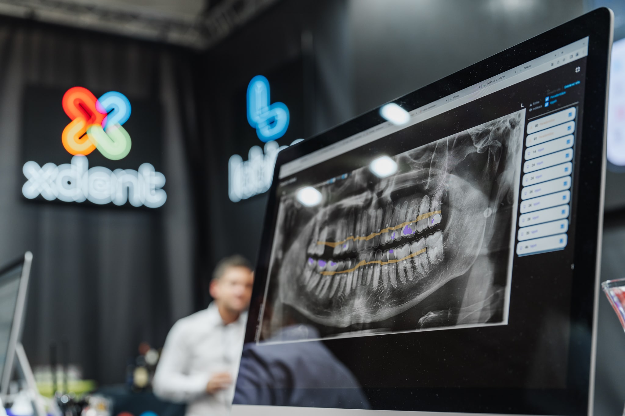 Stomatológia - XDENT
